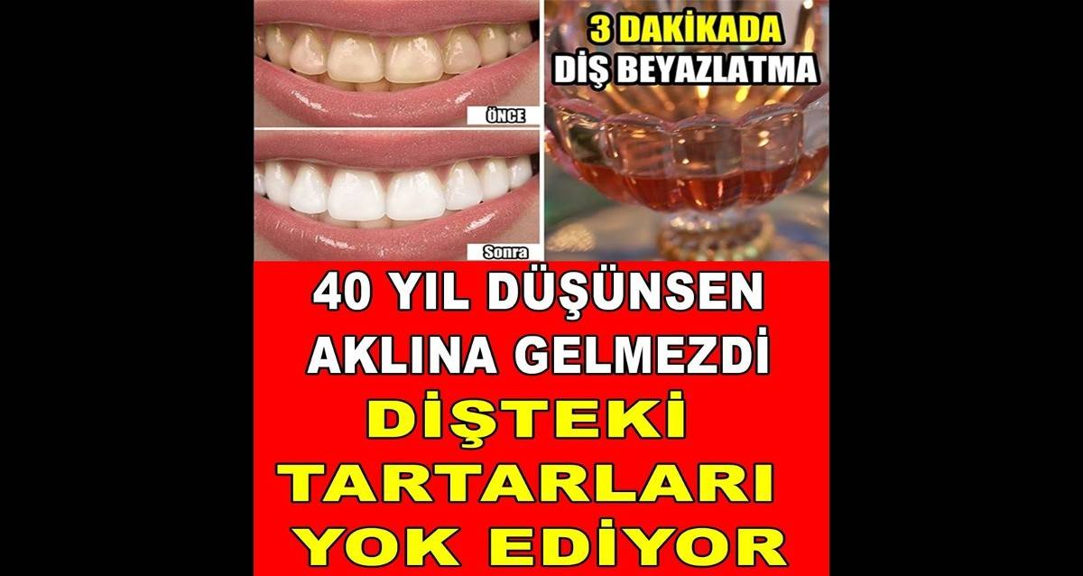 Evde 3 dakikada dişlerinizi beyazlatmak mümkün