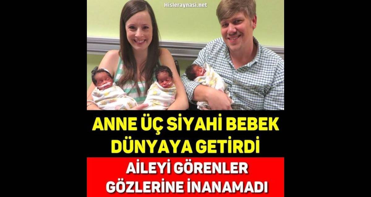 ANNE ÜÇ SİYAHİ BEBEK DÜNYAYA GETİRDİ AİLEYİ GÖRENLER GÖZLERİNE İNANAMADI